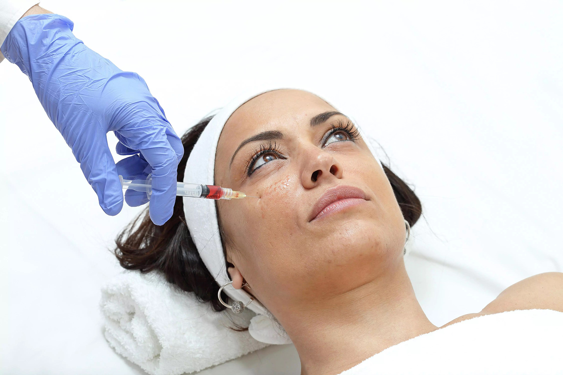 Cheek Filler Singapore