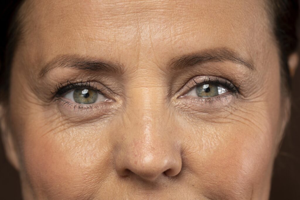 How Laser Helps with Wrinkles & Skin Tightening